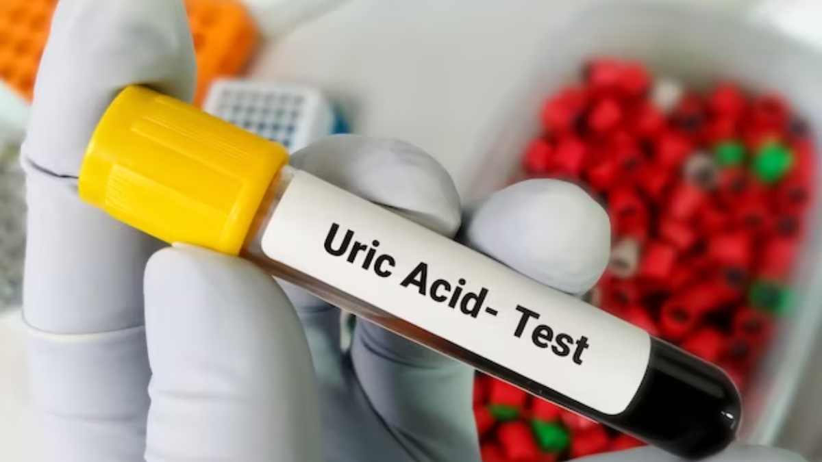 High Uric Acid के मरीज भूलकर भी न खाएं ये 7 फूड्स, एक्सपर्ट ने बताया ...