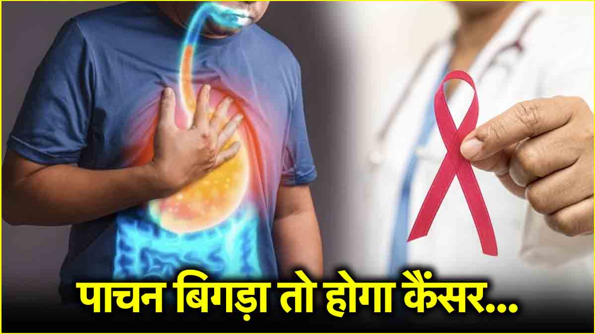Acidity के मरीजों को भी हो सकता है कैंसर! एक्सपर्ट का दावा कितना सही?
