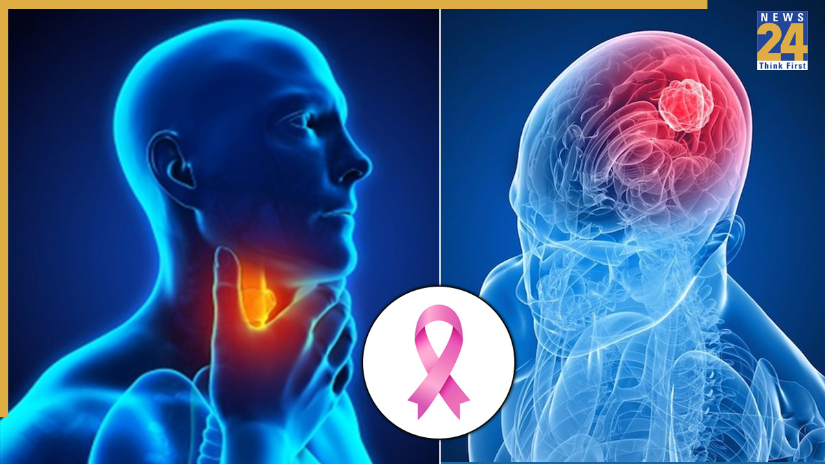 देश के युवाओं में बढ़ रहे सिर और गले के कैंसर के मामले, जानें लक्षण और ...