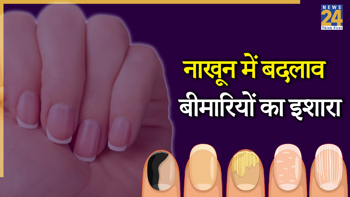 नाखून नहीं सिर्फ खूबसूरती नहीं, सेहत का रिपोर्ट कार्ड भी है, इन 5 ...