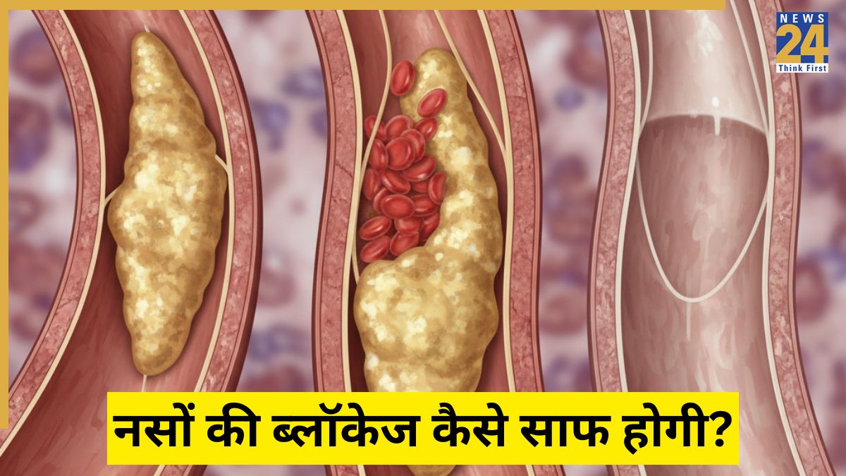 नसों में जमी गंदगी कैसे निकालें? डॉक्टर ने बताया डाइट में शामिल कर लीं ...