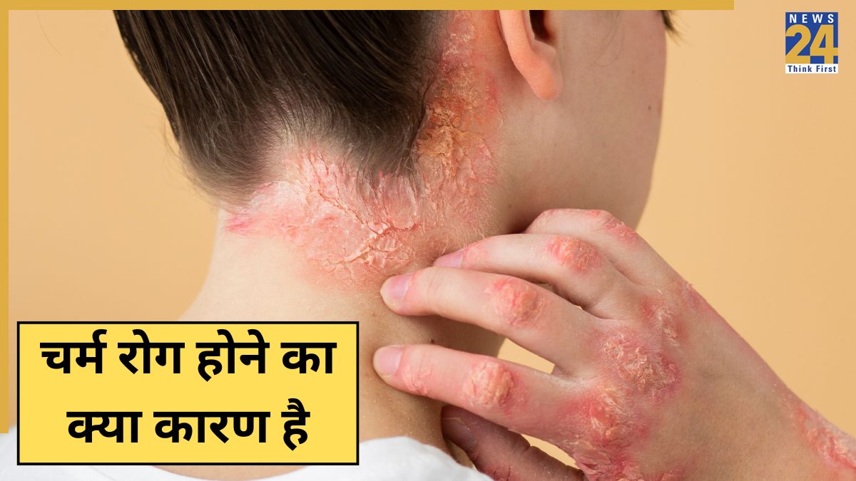 चर्म रोग होने का कारण क्या है? यहां जानिए दाद, खाज, खुजली जैसी Skin ...