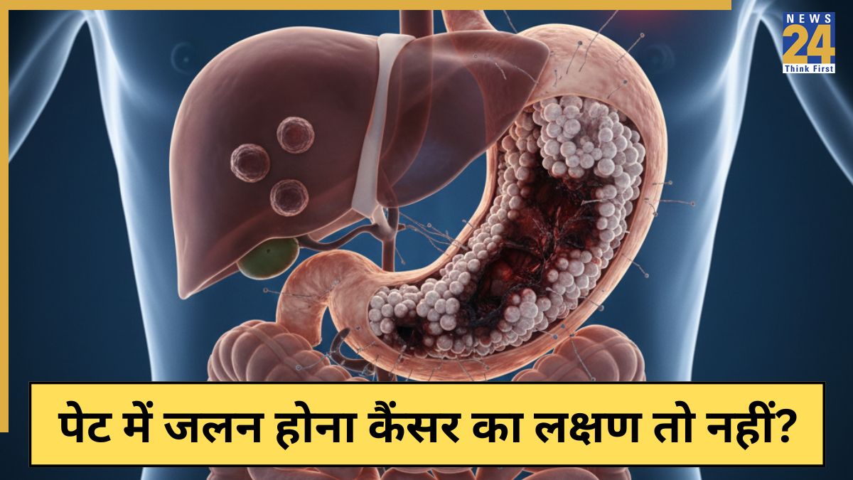 क्या पेट में जलन होना Stomach Cancer का संकेत होता है? यहां जानिए पेट ...