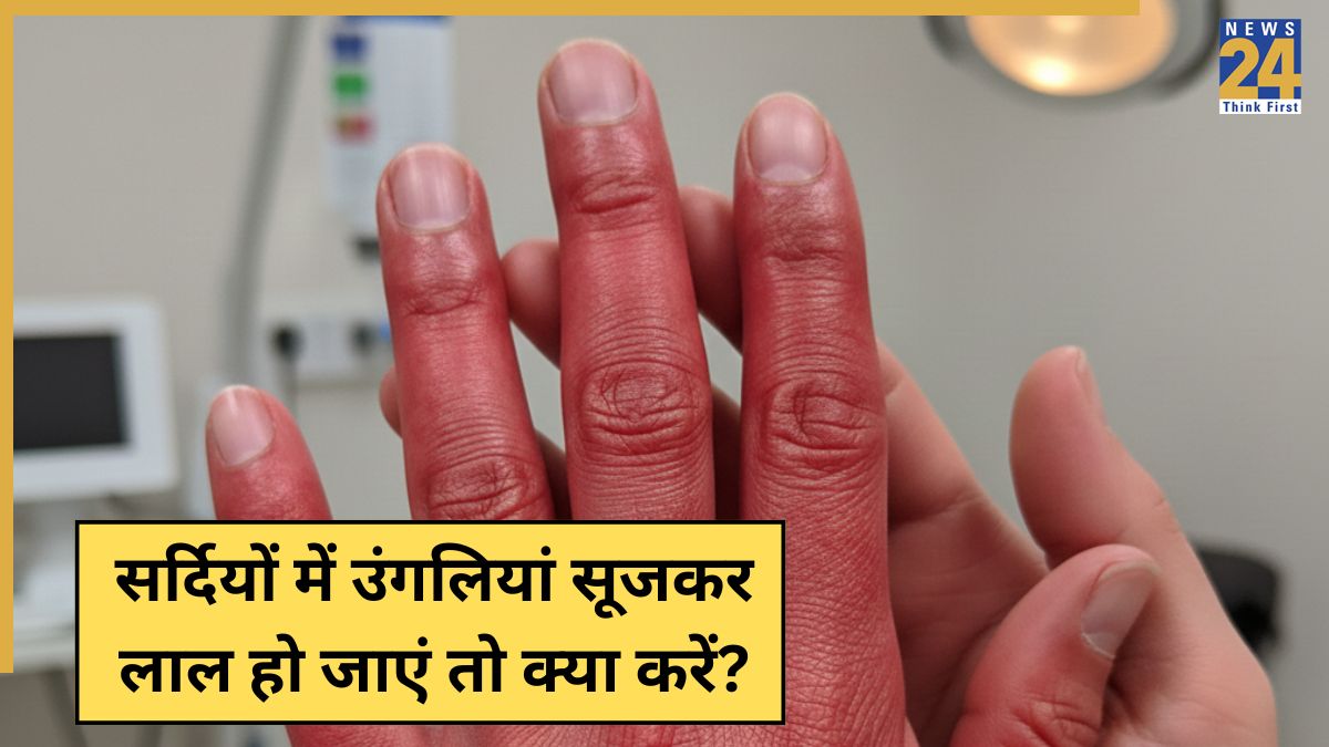 ठंड में उंगलियों की सूजन का इलाज क्या है? एक्सपर्ट ने बताया सर्दियों ...
