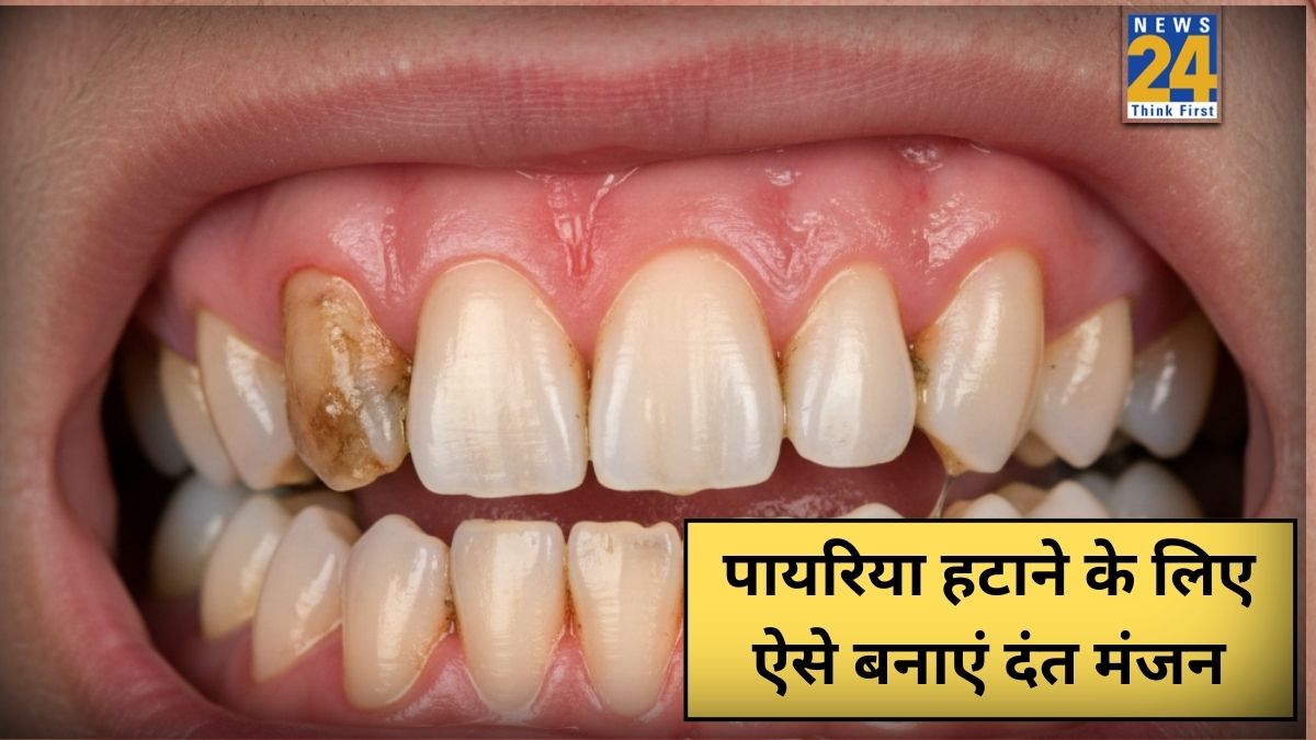 क्या पायरिया घर पर ठीक हो सकता है? बाबा रामदेव ने बताया ऐसे बनाएं दंत ...