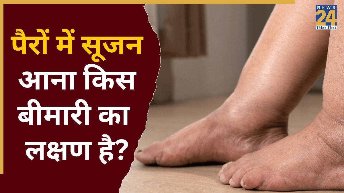 पैरों की सूजन किस बीमारी का संकेत देती है? - swollen feet causes Which ...