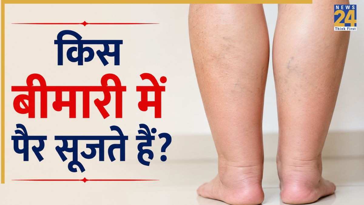 पैरों में सूजन और खुजली किसी बीमारी का लक्षण तो नहीं? मैक्स हॉस्पिटल के ...