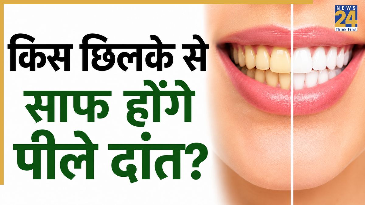 किस फल के छिलके से साफ हो सकते हैं पीले दांत? तुरंत जान लीजिए यह कमाल ...